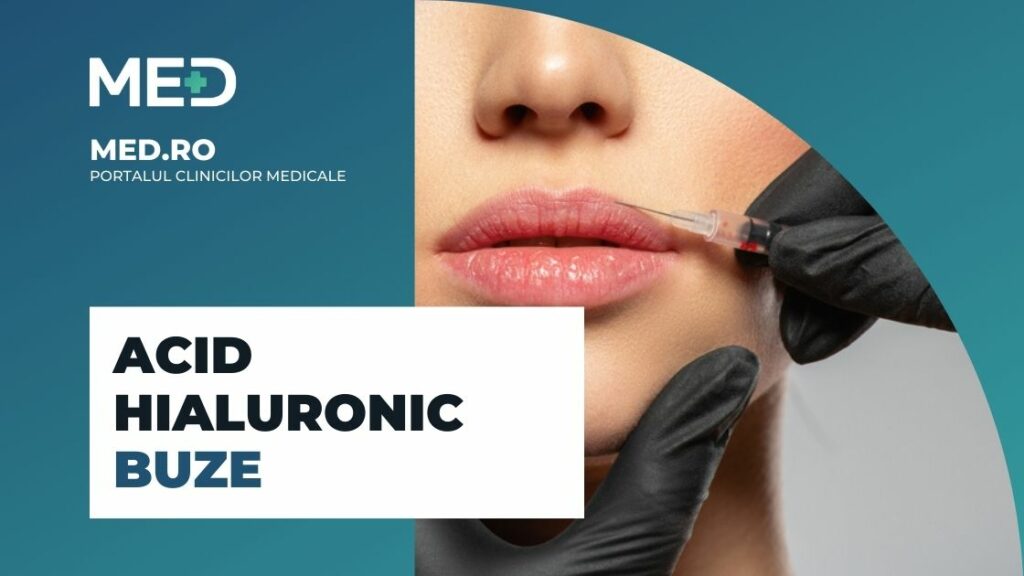 Acid hialuronic buze: tot ce trebuie sa stii de la tipuri la preturi