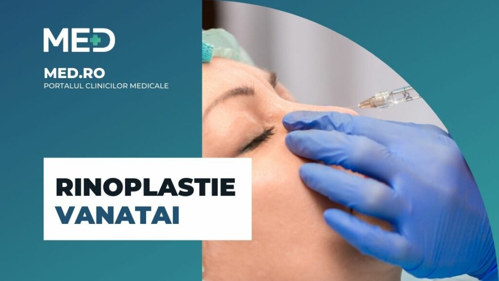 rinoplastie vanatai - Med.Ro