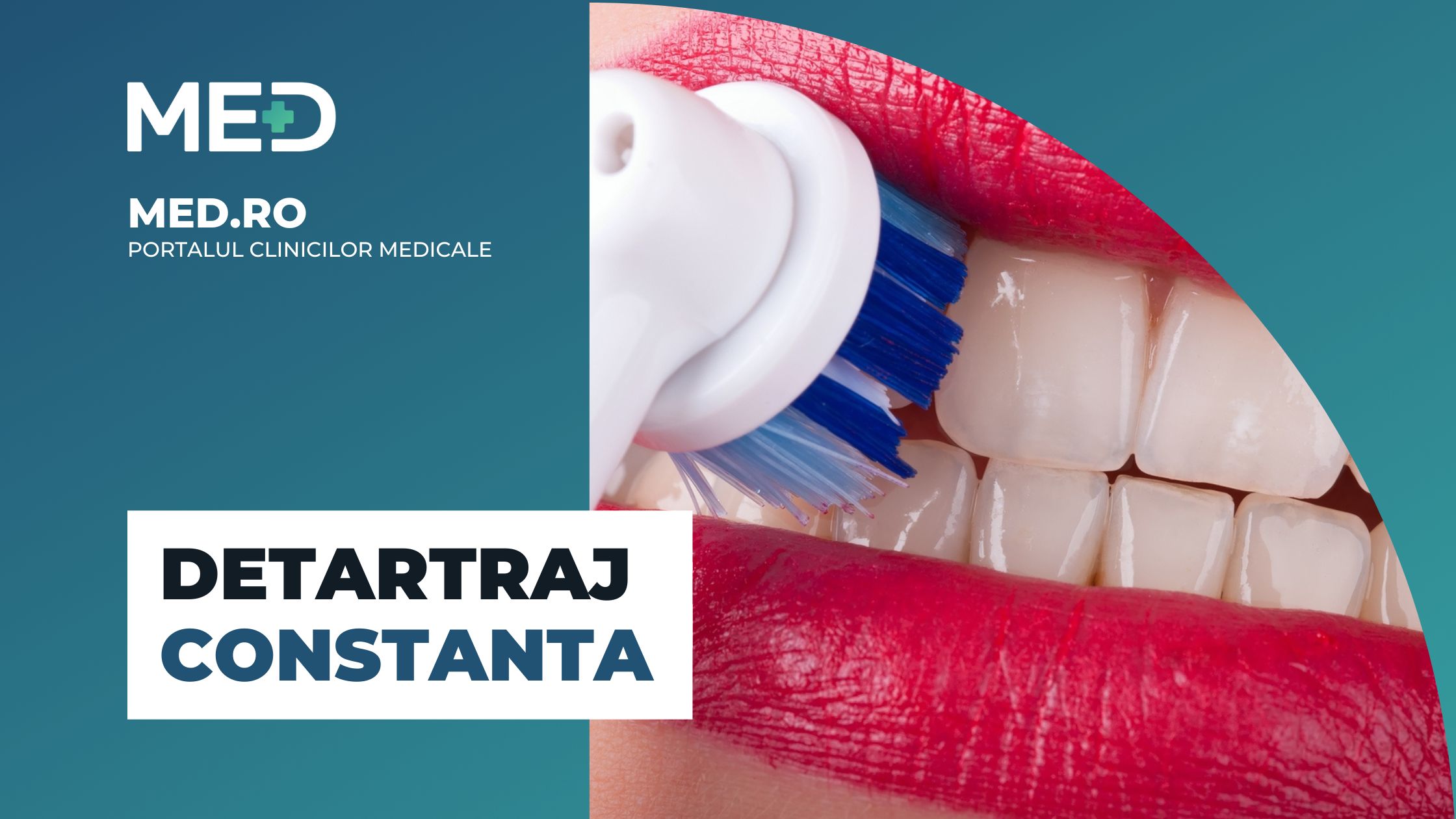 Detartraj Constanta – Top 5 Clinici, Prețuri & Programare Online