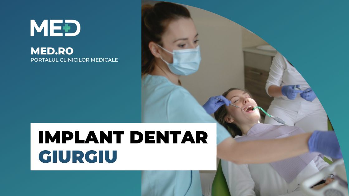 Implant dentar Giurgiu – Top 5 Clinici, Prețuri & Programare Online