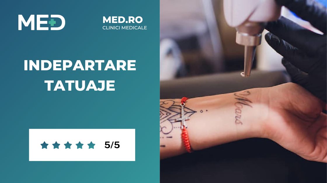 Indepartare Tatuaj Baia Mare - Clinica verificata - Med.ro