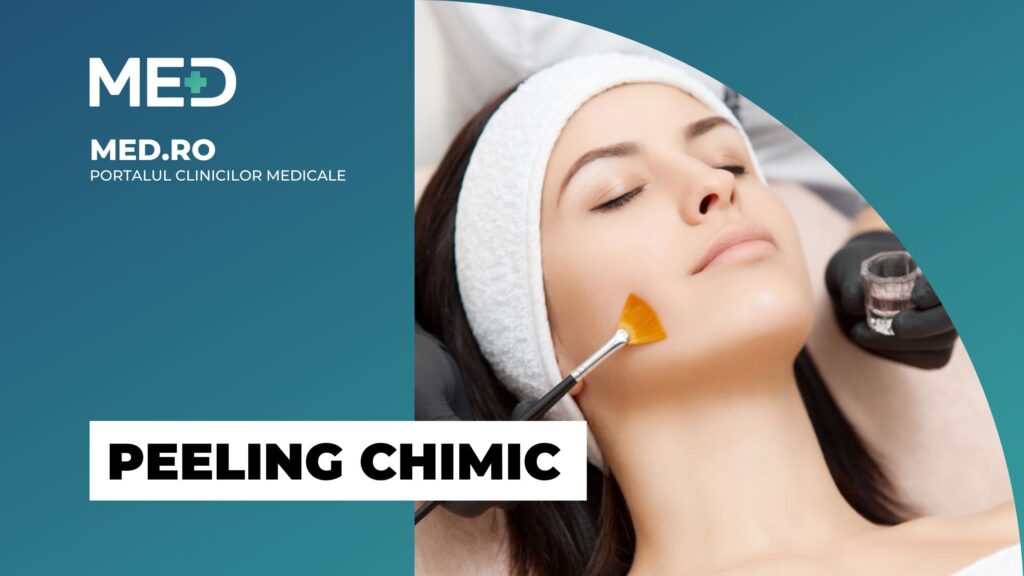 Peeling chimic - Med.Ro