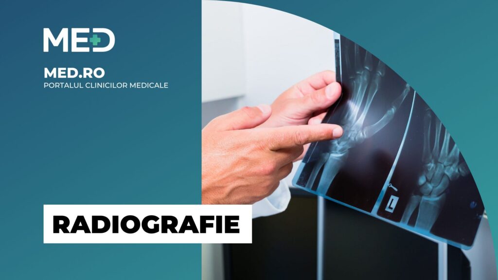 Radiografie - Med.Ro