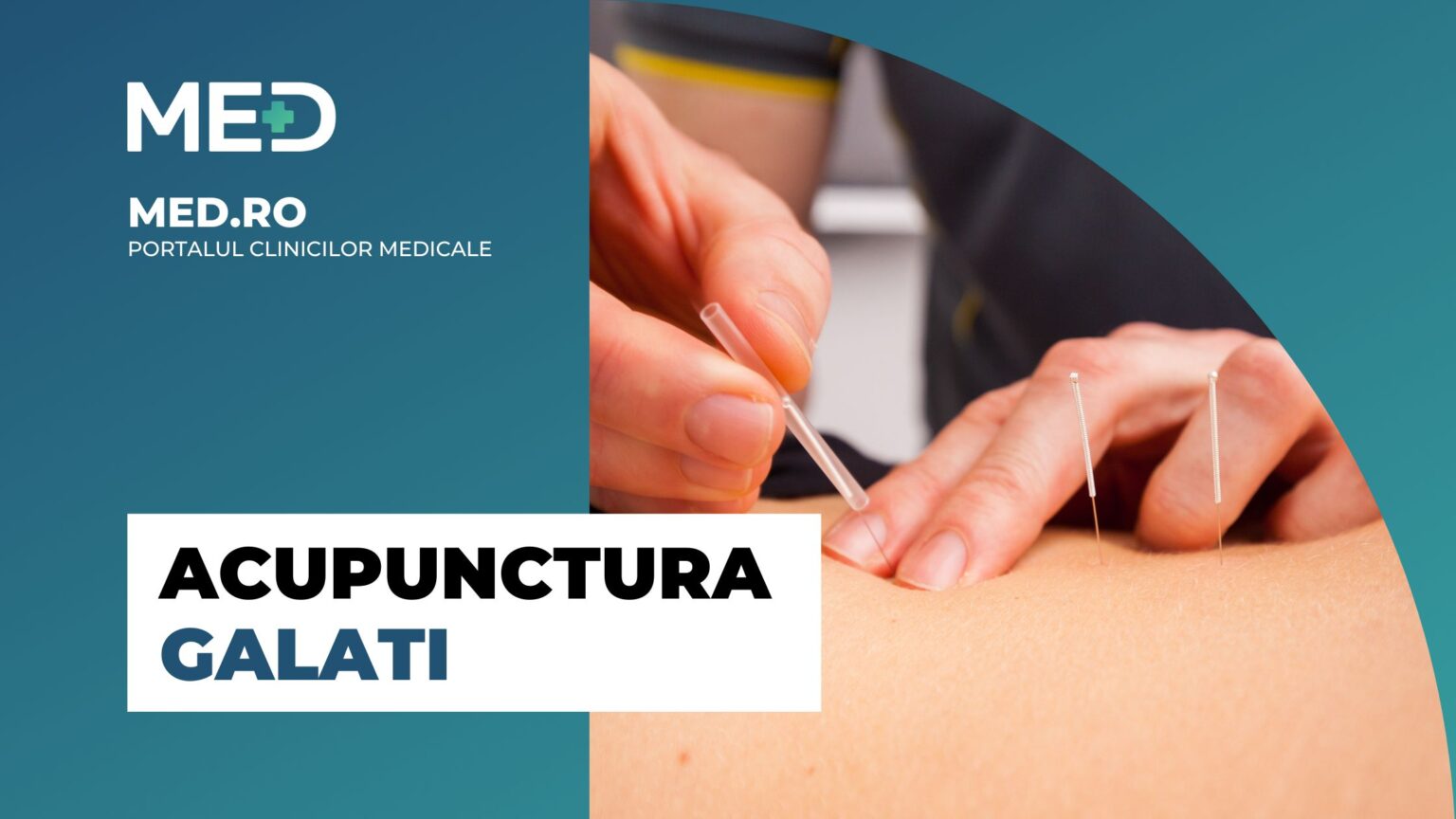 Acupunctura Galati - Clinica verificata - Med.ro