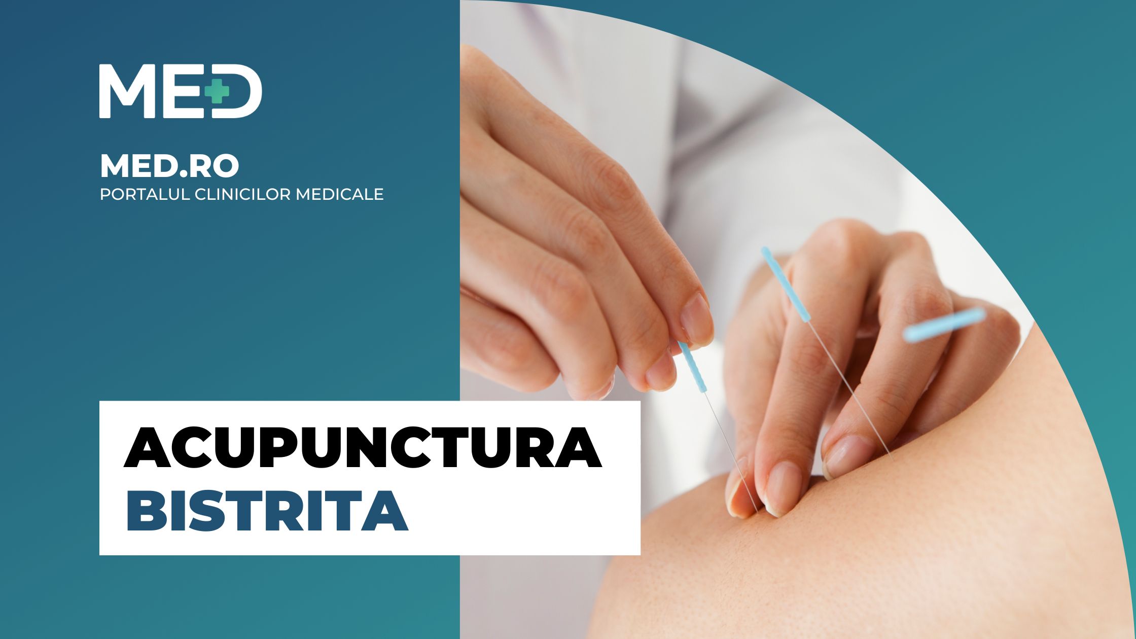 Acupunctura Bistrita – Top Clinici, Prețuri & Programare Online