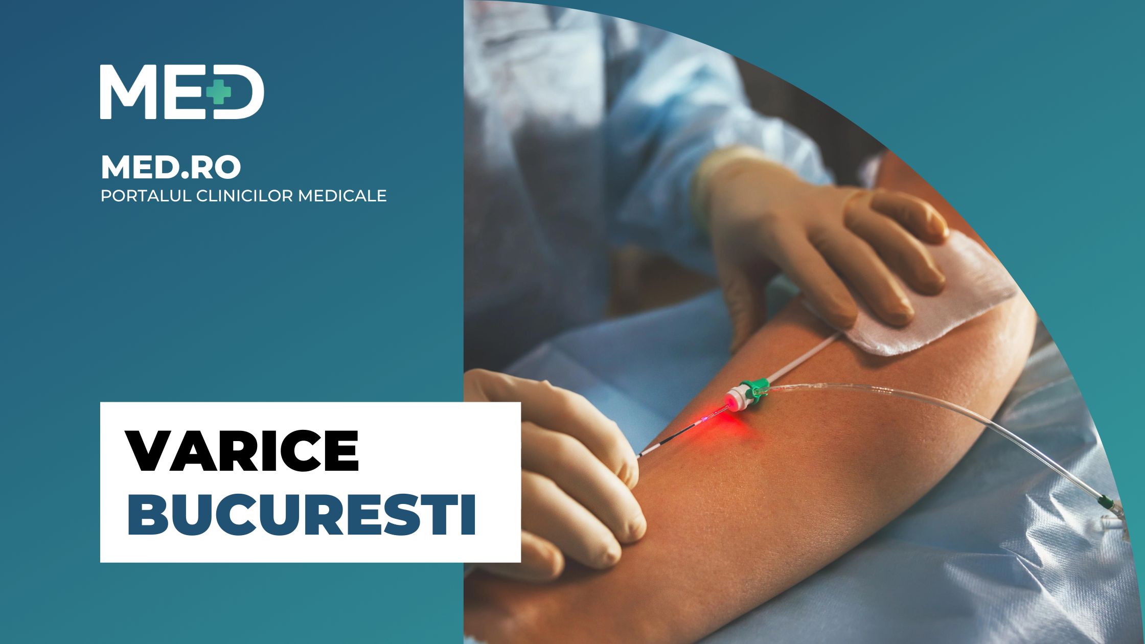 Varice Bucuresti – Top 5 Clinici, Prețuri & Programare Online